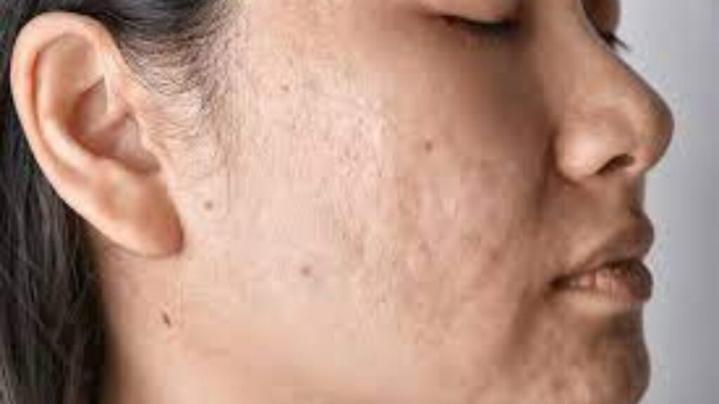 How the Best Dermatologists in Singapore Treat Asian Skin Conditions